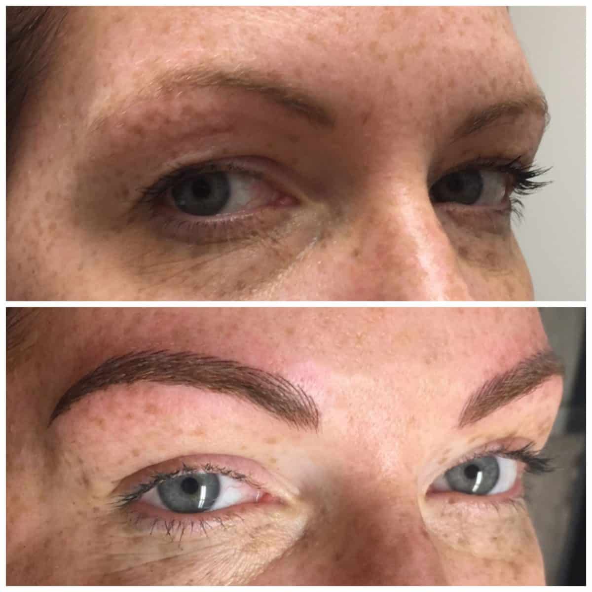 Microblading Treatments in Atlanta | Buckhead Plastic Surgery