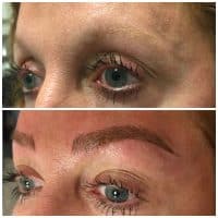 Microblading Treatments in Atlanta | Buckhead Plastic Surgery
