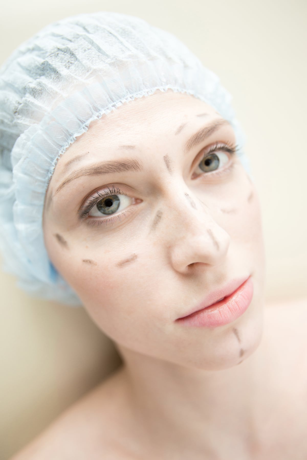 The Most Asked Questions About Facelift Surgery | Alan N Larsen MD