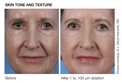 Contour TRL for a Flawless Youthful Complexion