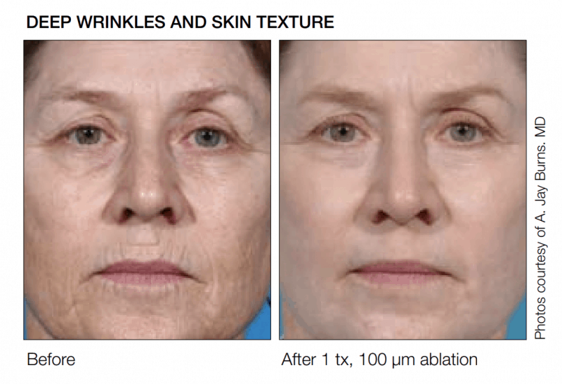 Contour TRL for a Flawless Youthful Complexion