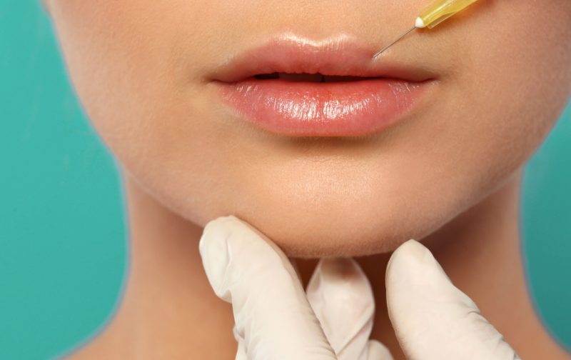 Your Guide to the Perfect Pout | Buckhead Plastic Surgery | Atlanta GA
